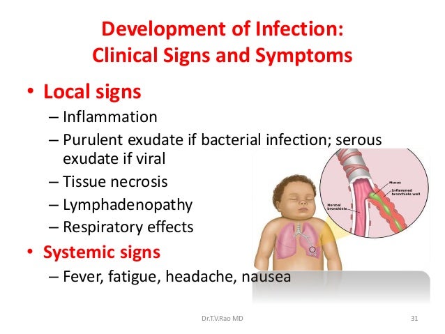 INFECTIOUS DISEASESvAETIOLOGY PATHOGENESIS &vCONSEQUENCES