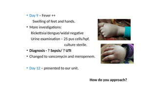 Infection Mimics in Pediatrics .pptx
