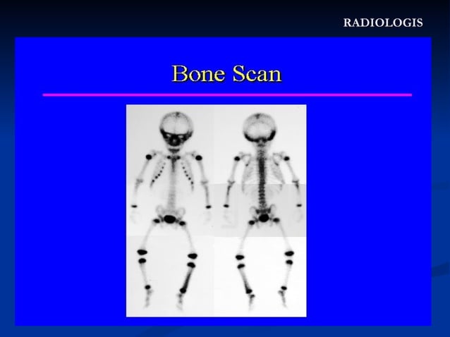 Infection of bone and joint | PPT