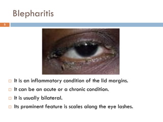 infection of eye and cataract.pdf