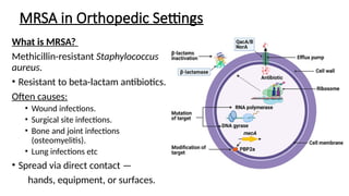 Infection Prevention and Control/MRSA infection | PPTX