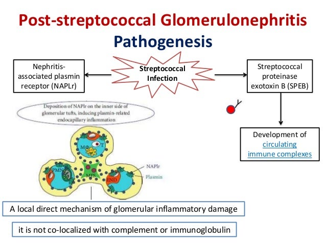Infection Related Glomerulopathy Introduction Rapid Overview