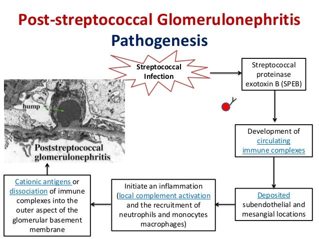 Infection Related Glomerulopathy - Introduction – Rapid Overview
