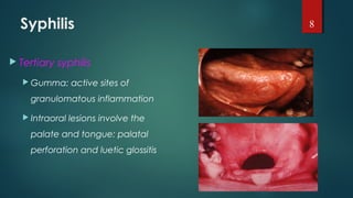 Infections | PPT