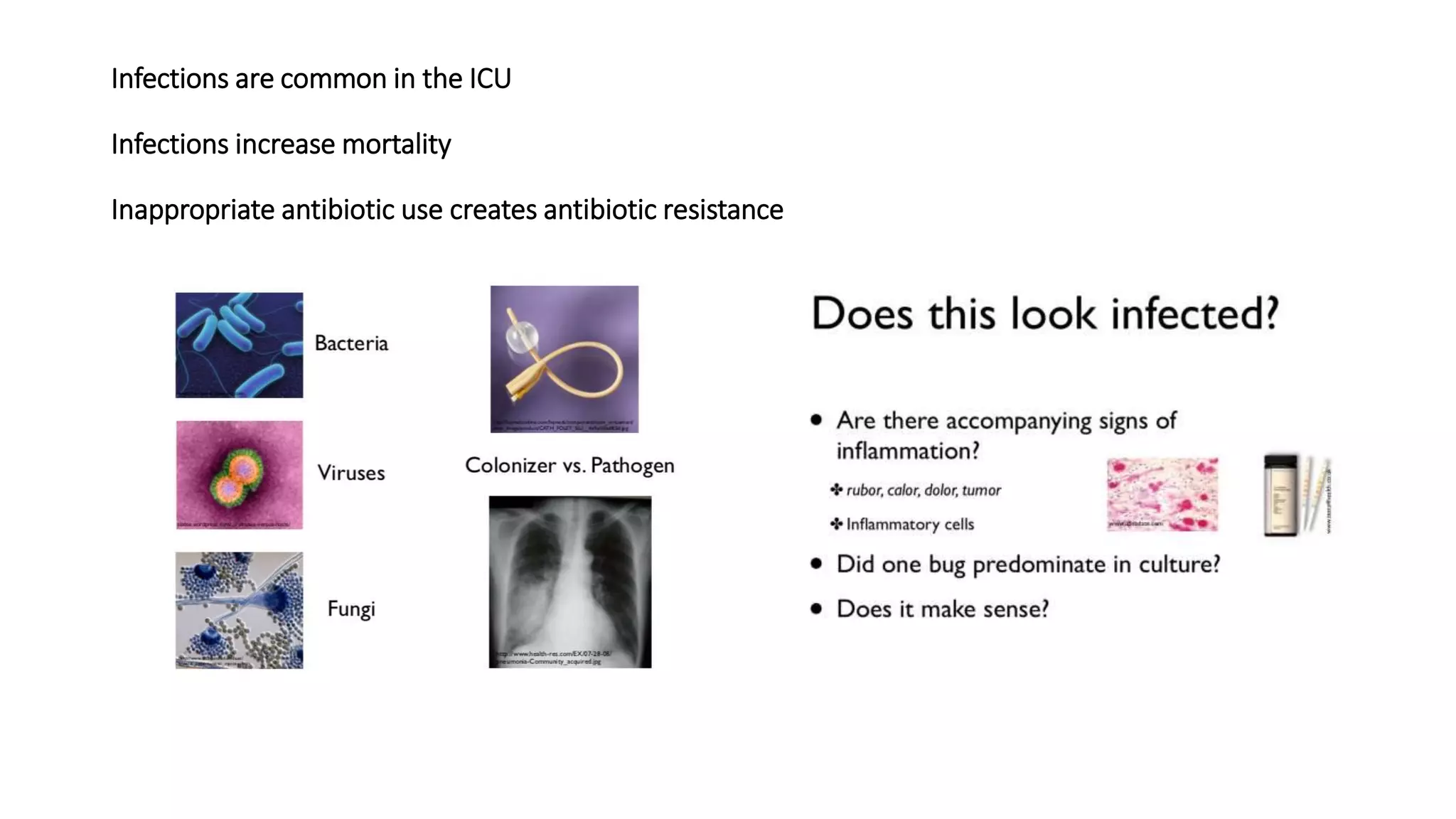 Infection Prevention and Control in the ICU | PPTX | Infectious Diseases | Diseases and Conditions
