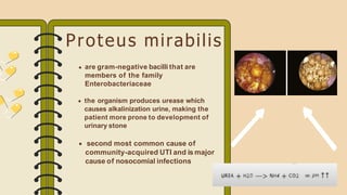 Infections-of-the-Urinary-Tract.pptx