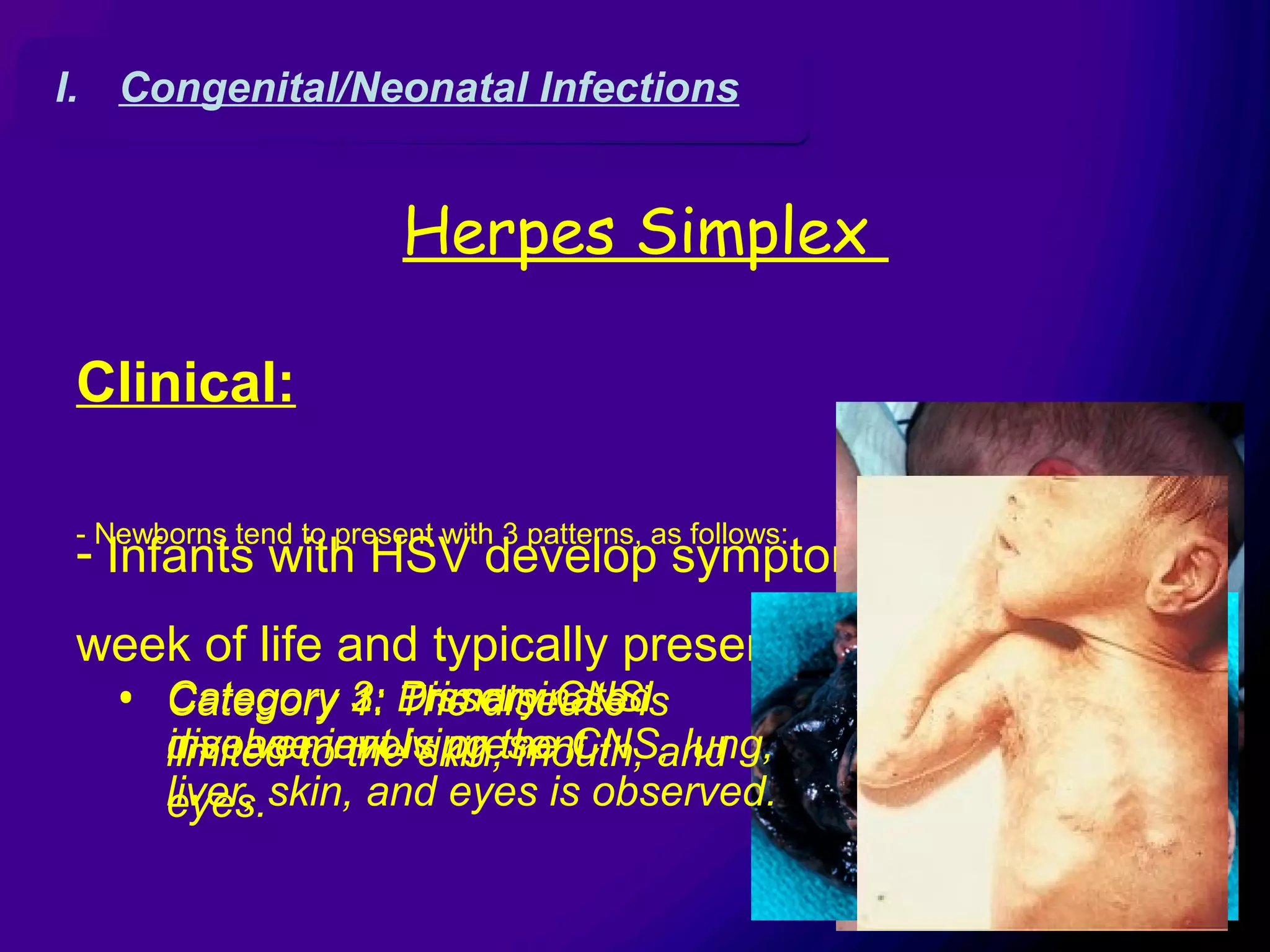 Brain Infections 1 | PPT