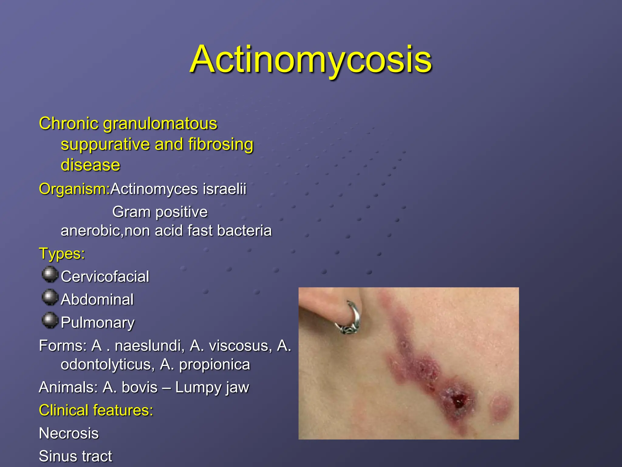 Common Infections Affecting The Human Body | PPT