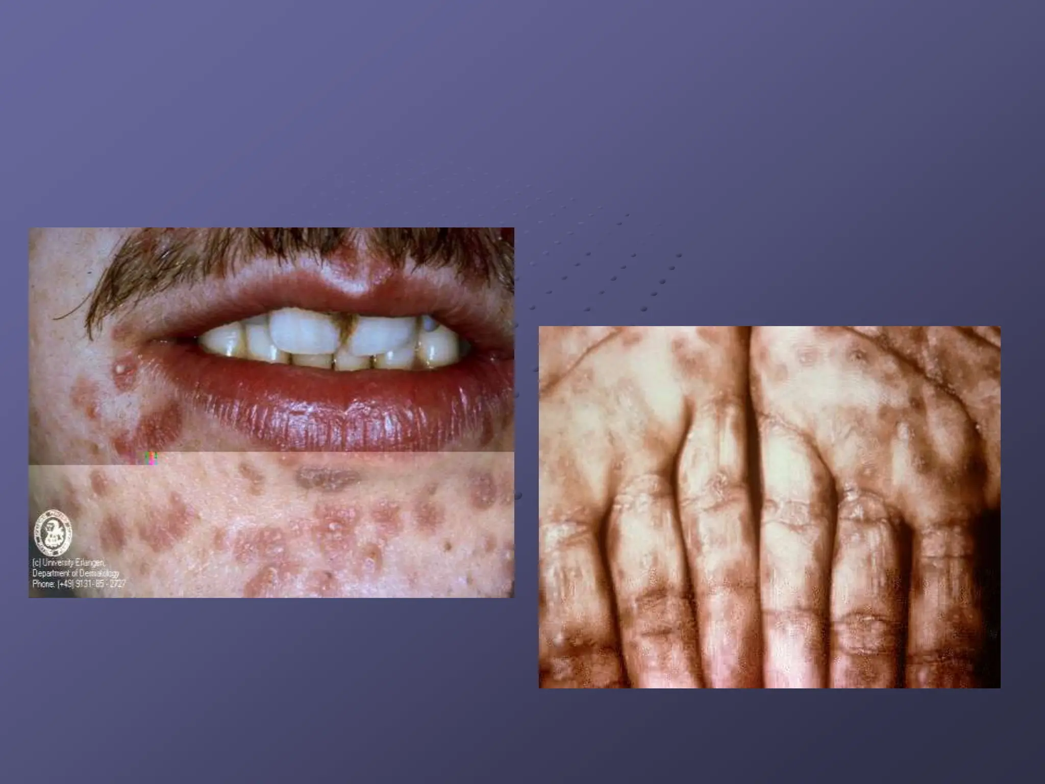 Common Infections Affecting The Human Body | PPT