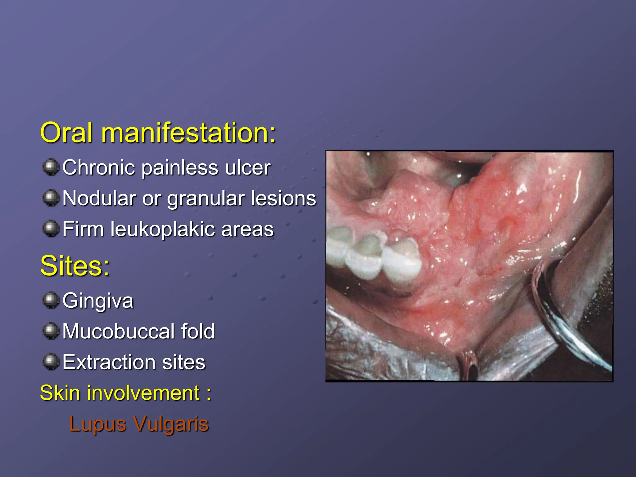 Common Infections Affecting The Human Body | PPT