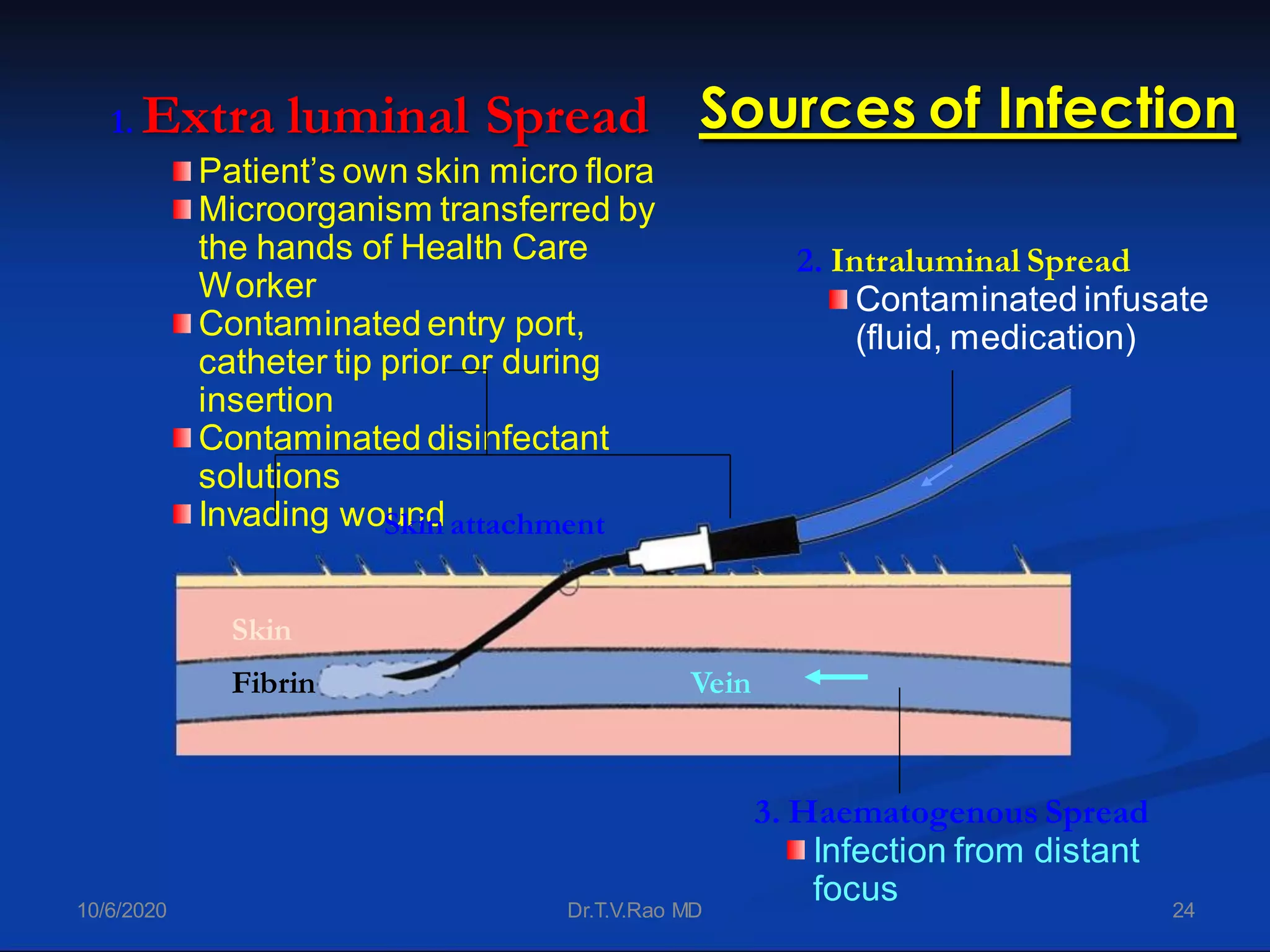 INFECTIONS IN INTENSIVE CARE UNITS Detection, Caring Prevention | PDF