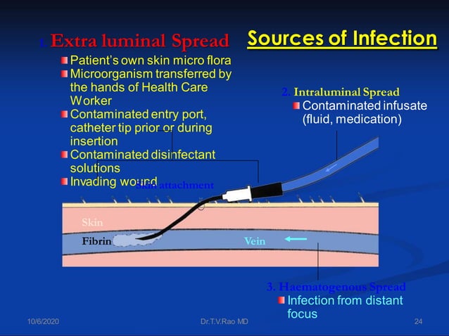 INFECTIONS IN INTENSIVE CARE UNITS Detection, Caring Prevention | PDF ...