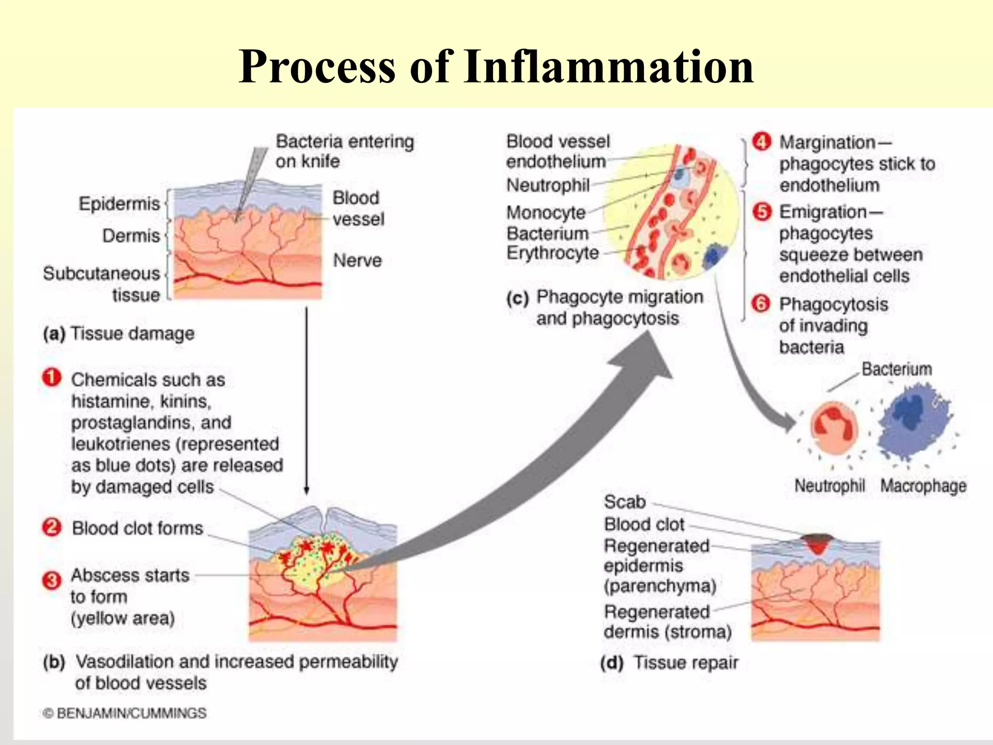 Infections in immunocompromised patients | PPT