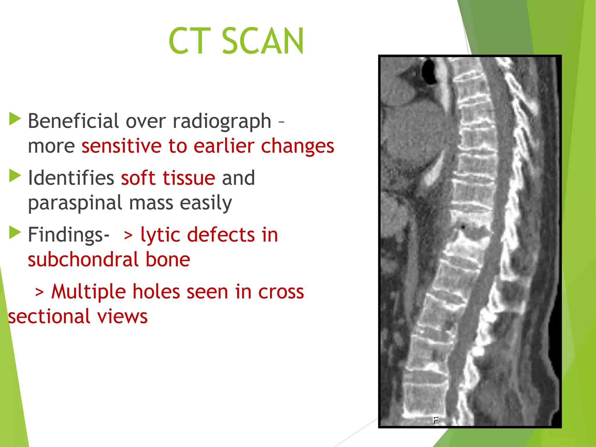 Infections of spine : Pyogenic and tuberculosis | PPT