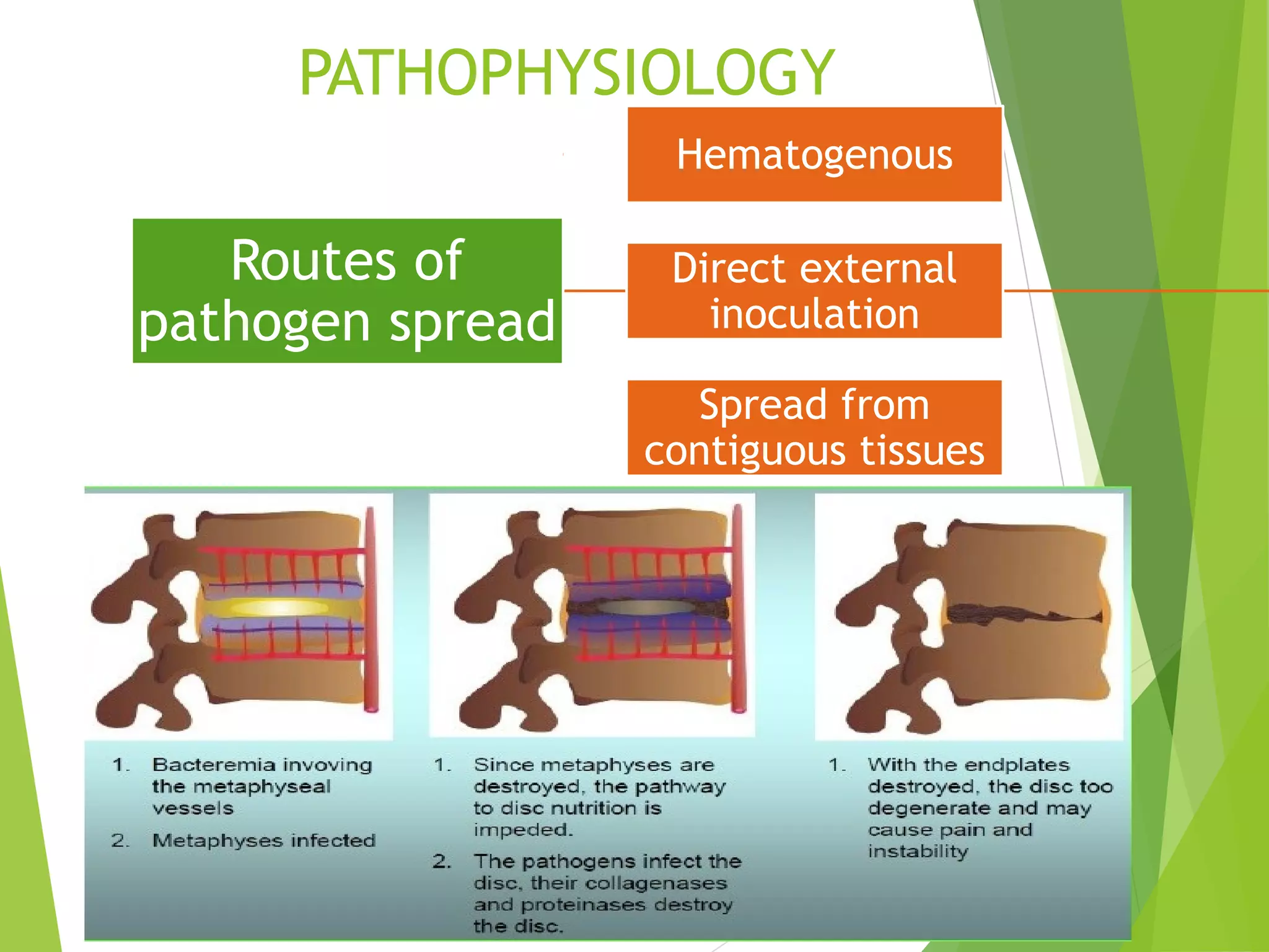 Infections of spine : Pyogenic and tuberculosis | PPT