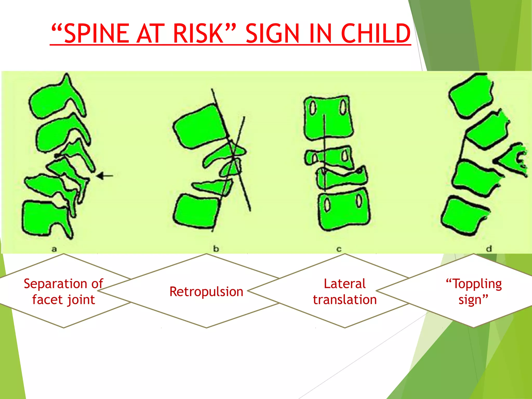 Infections of spine : Pyogenic and tuberculosis | PPT