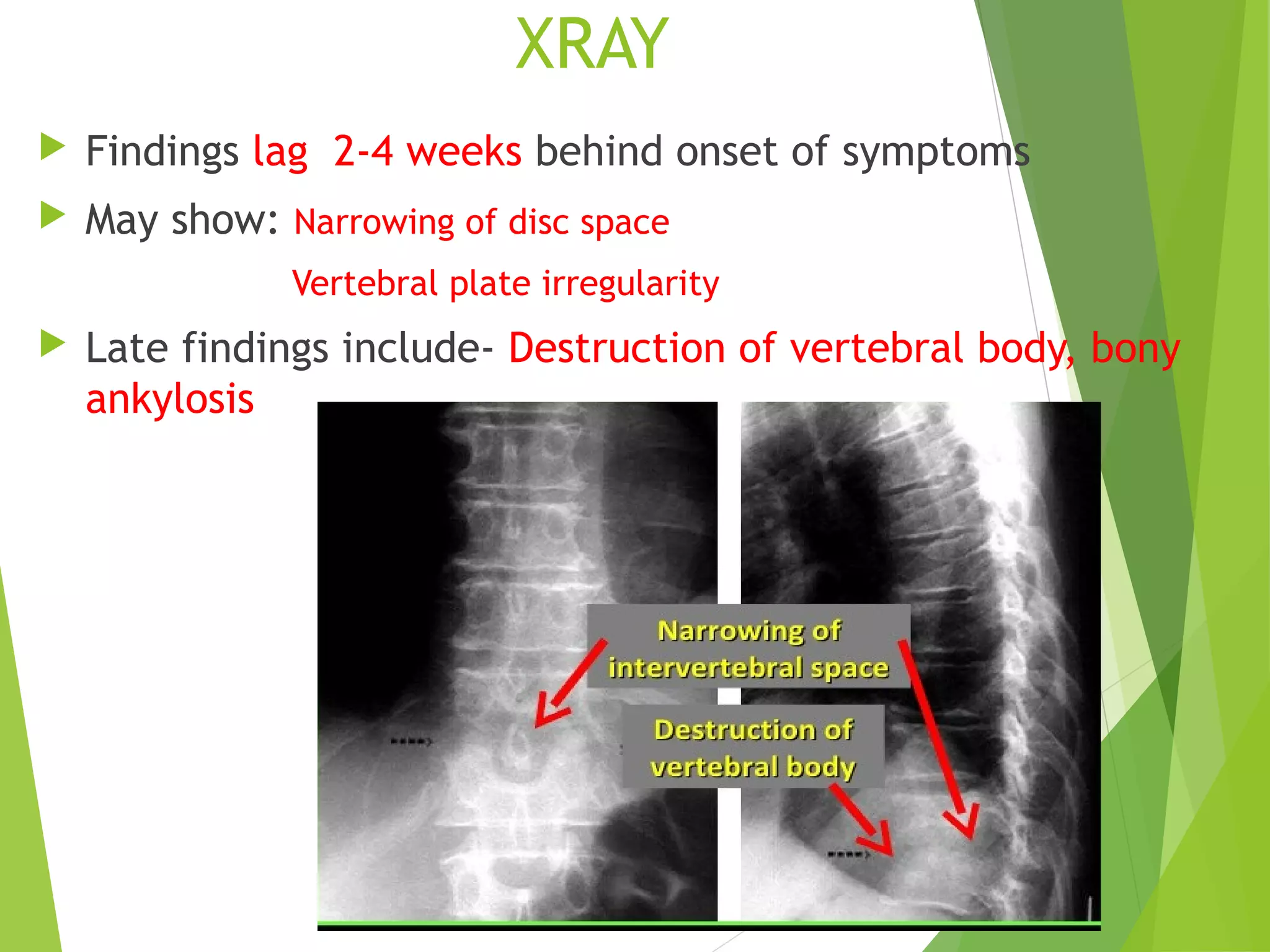 Infections of spine : Pyogenic and tuberculosis | PPT