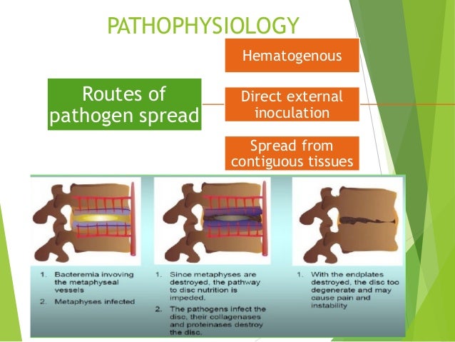 Infections of spine : Pyogenic and tuberculosis