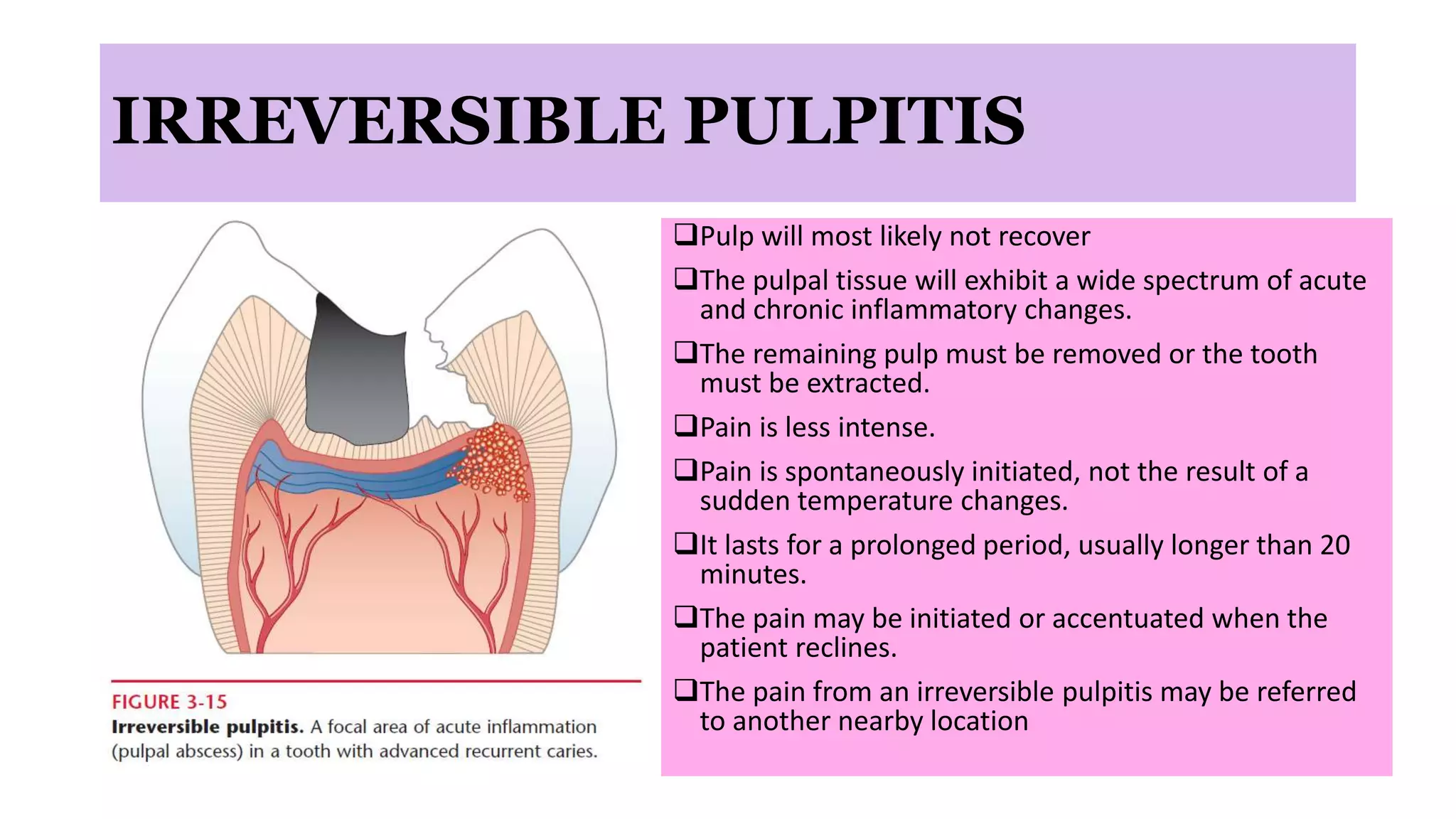Infections of teeth and bone - Oral Pathology | PPTX