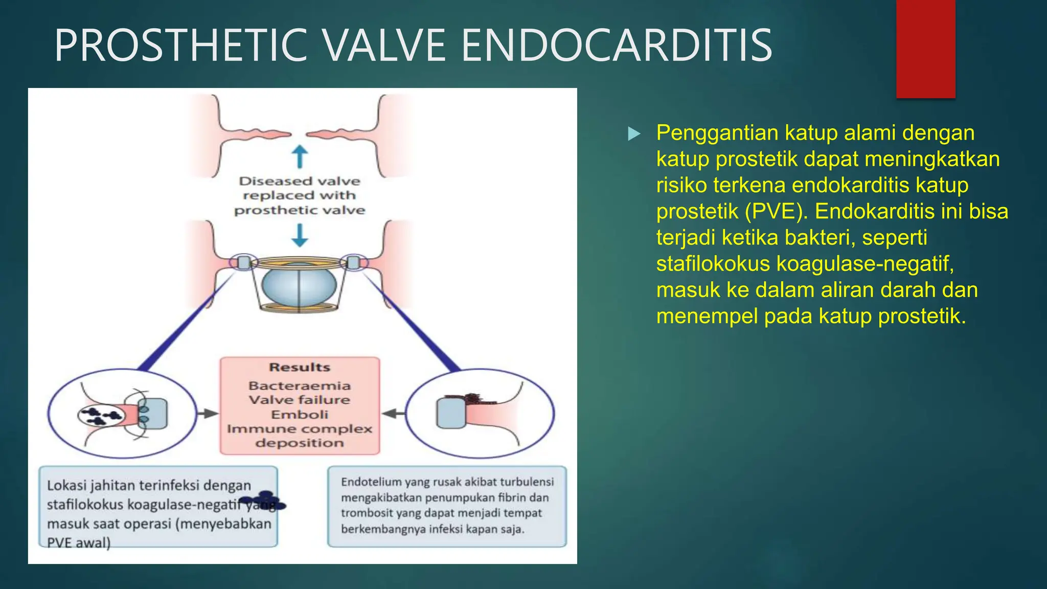 medical mikrobiology Infections of the Blood.pptx