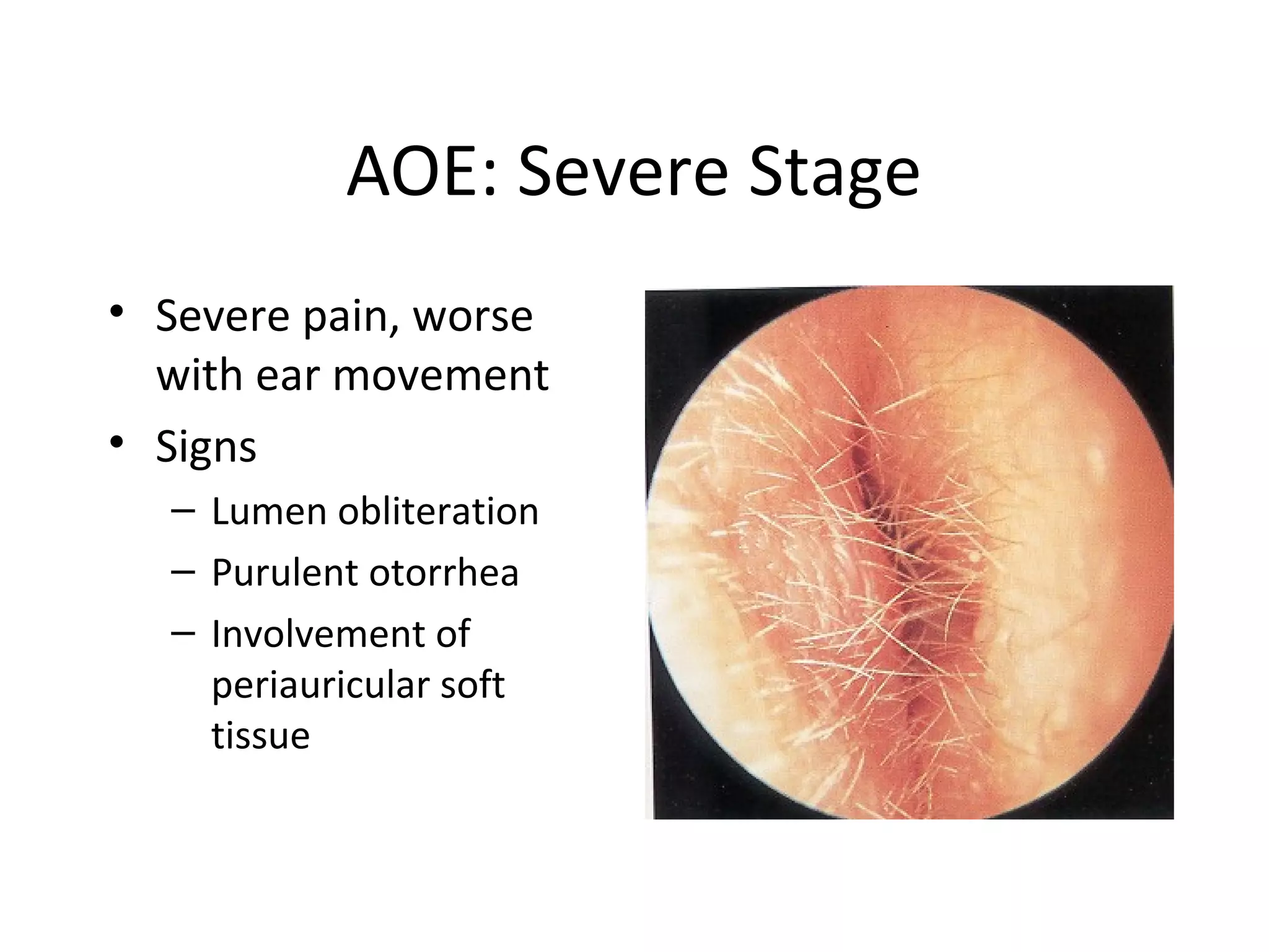 Infections of the external ear | PPT