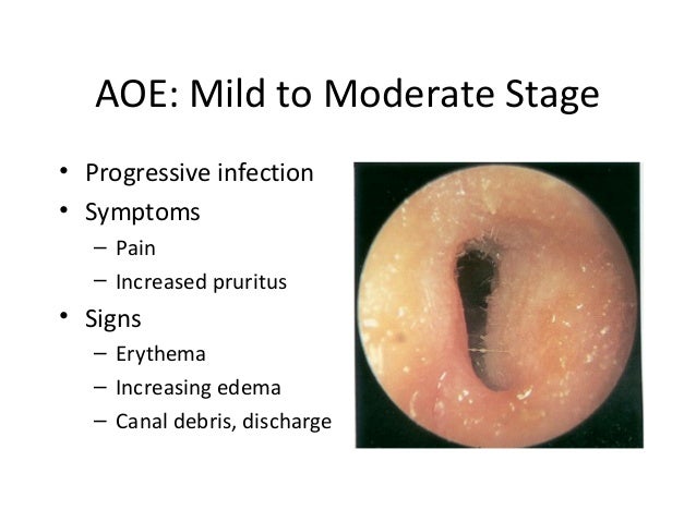Right Ear Inflammation