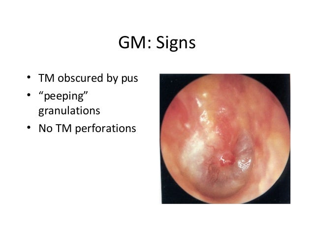 Infections of the external ear