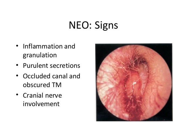 Infections of the external ear