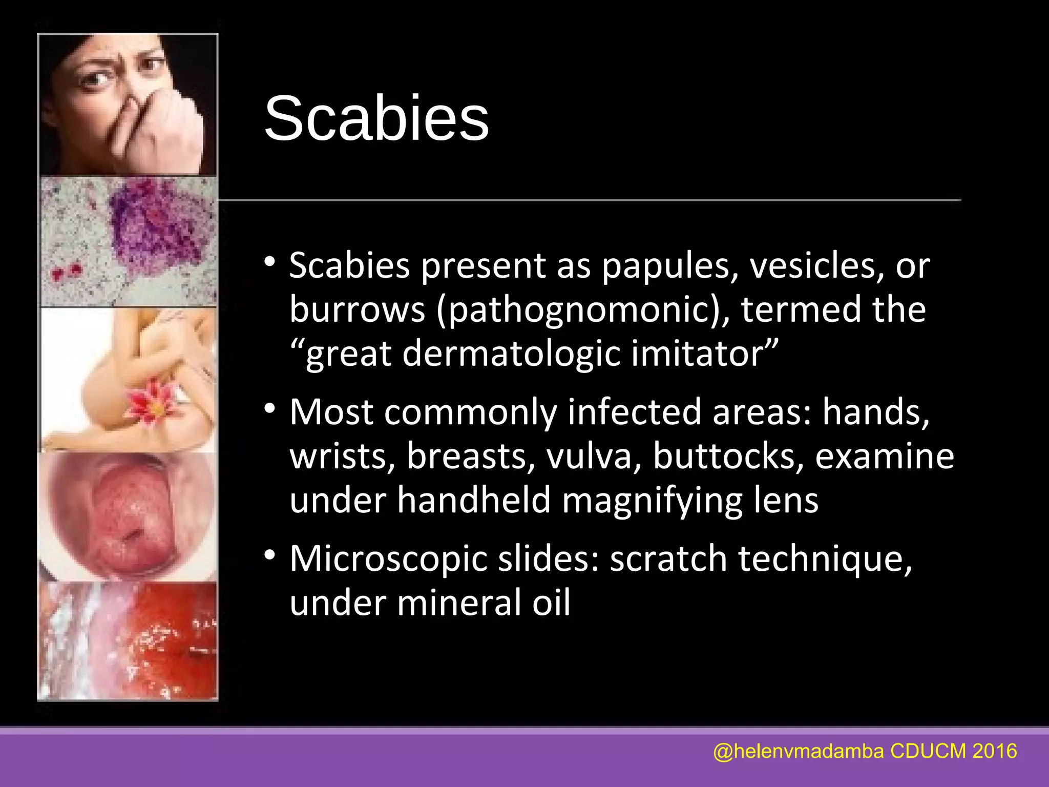 Infections of the Genital Tract - Part I | PPT