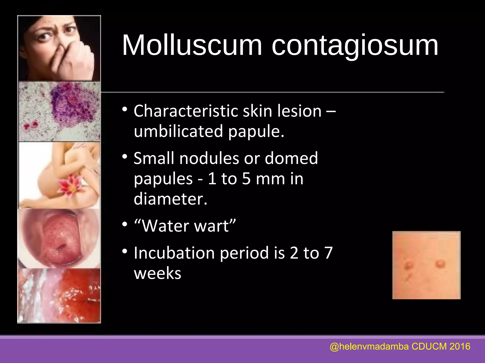 Infections of the Genital Tract - Part I | PPT
