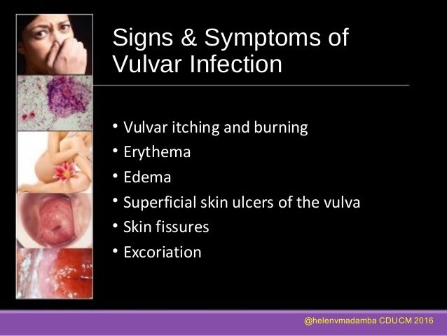 Infections of the Genital Tract - Part I