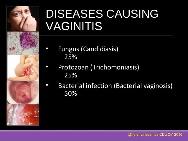 Infections of the Genital Tract - Part II