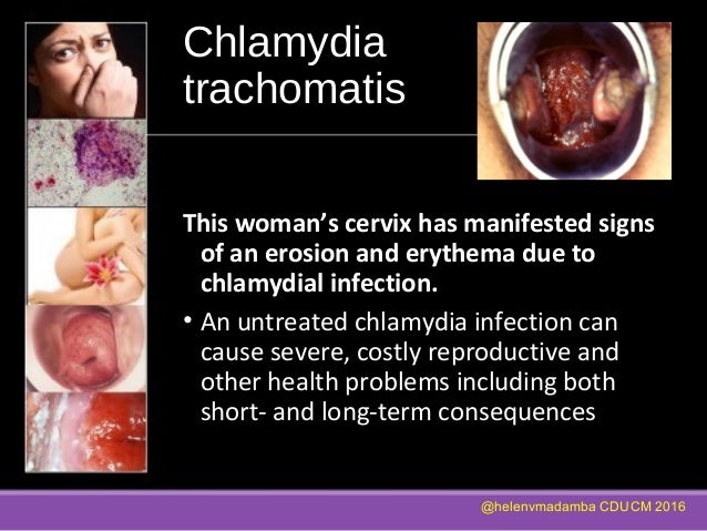 Infections of the Genital Tract - Part III