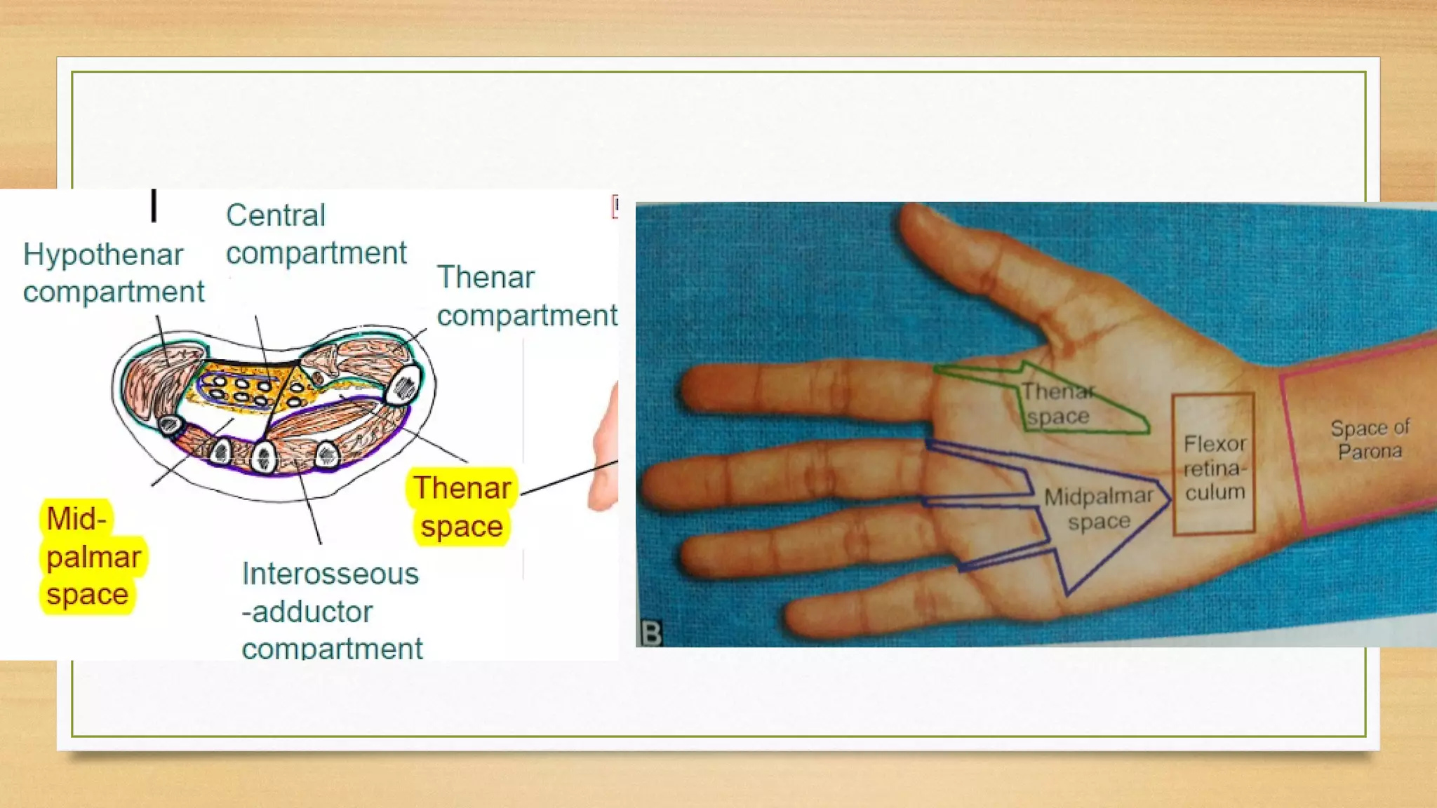 Infections of the hand | PPT