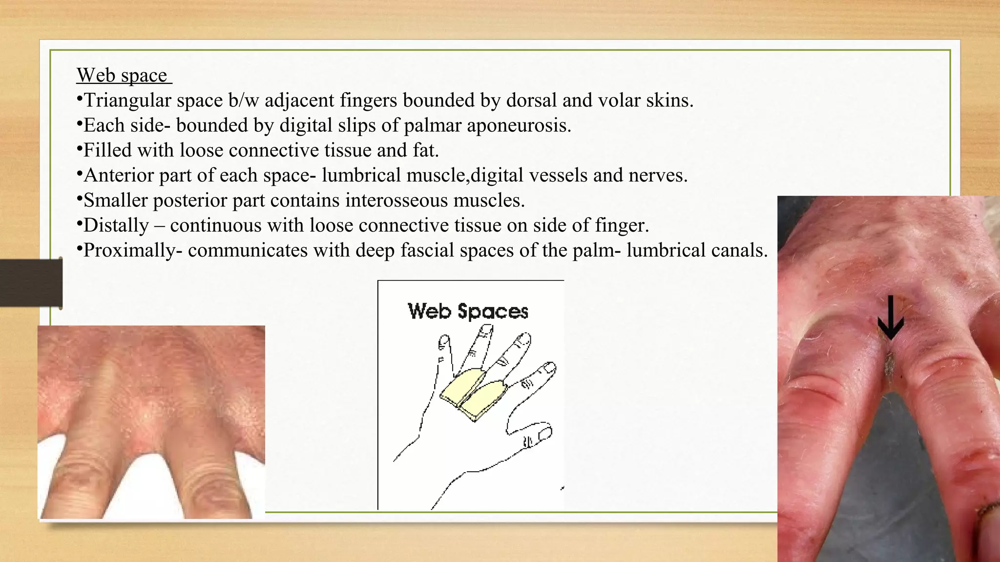Infections of the hand | PPT