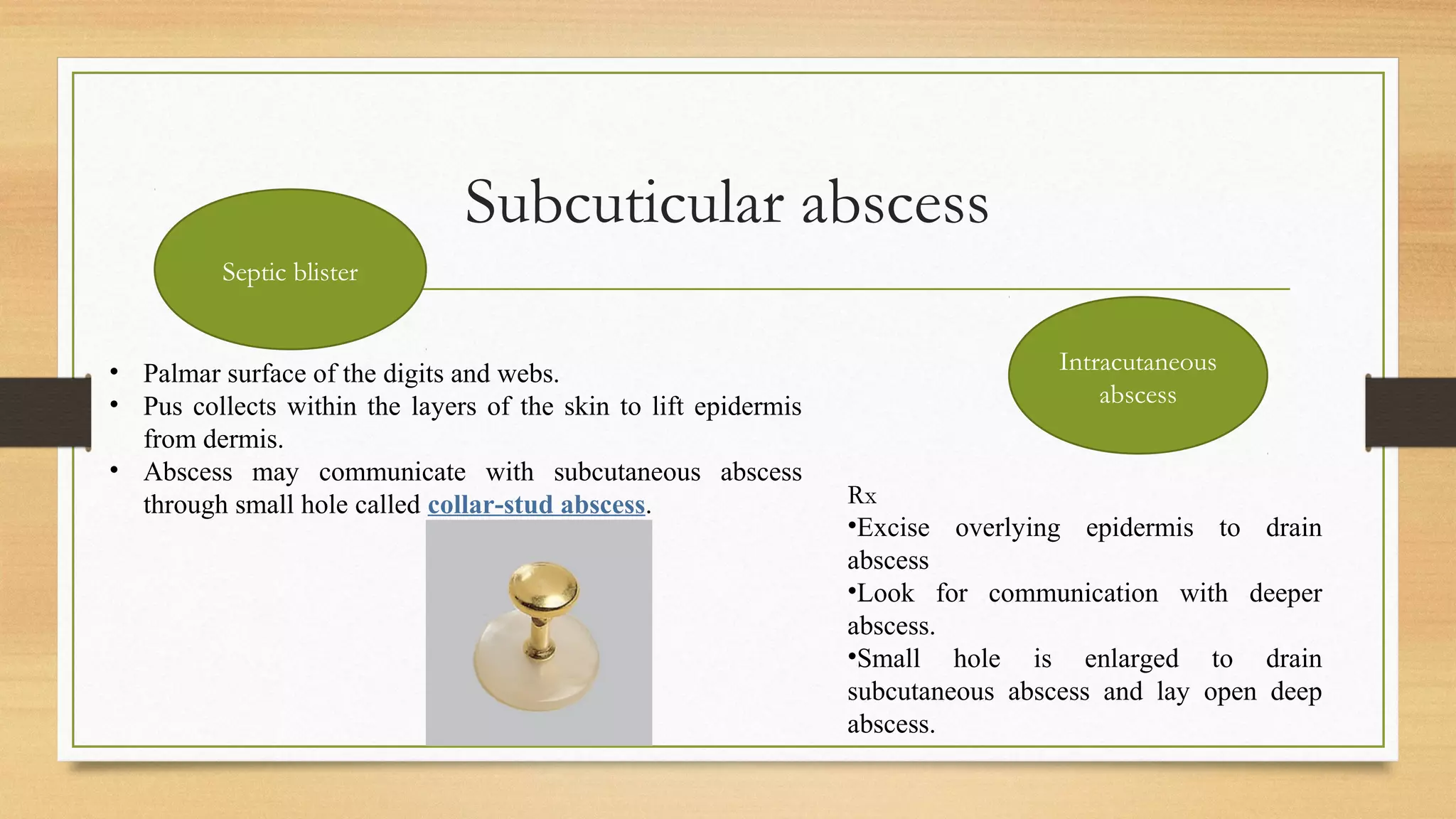 Infections of the hand | PPT