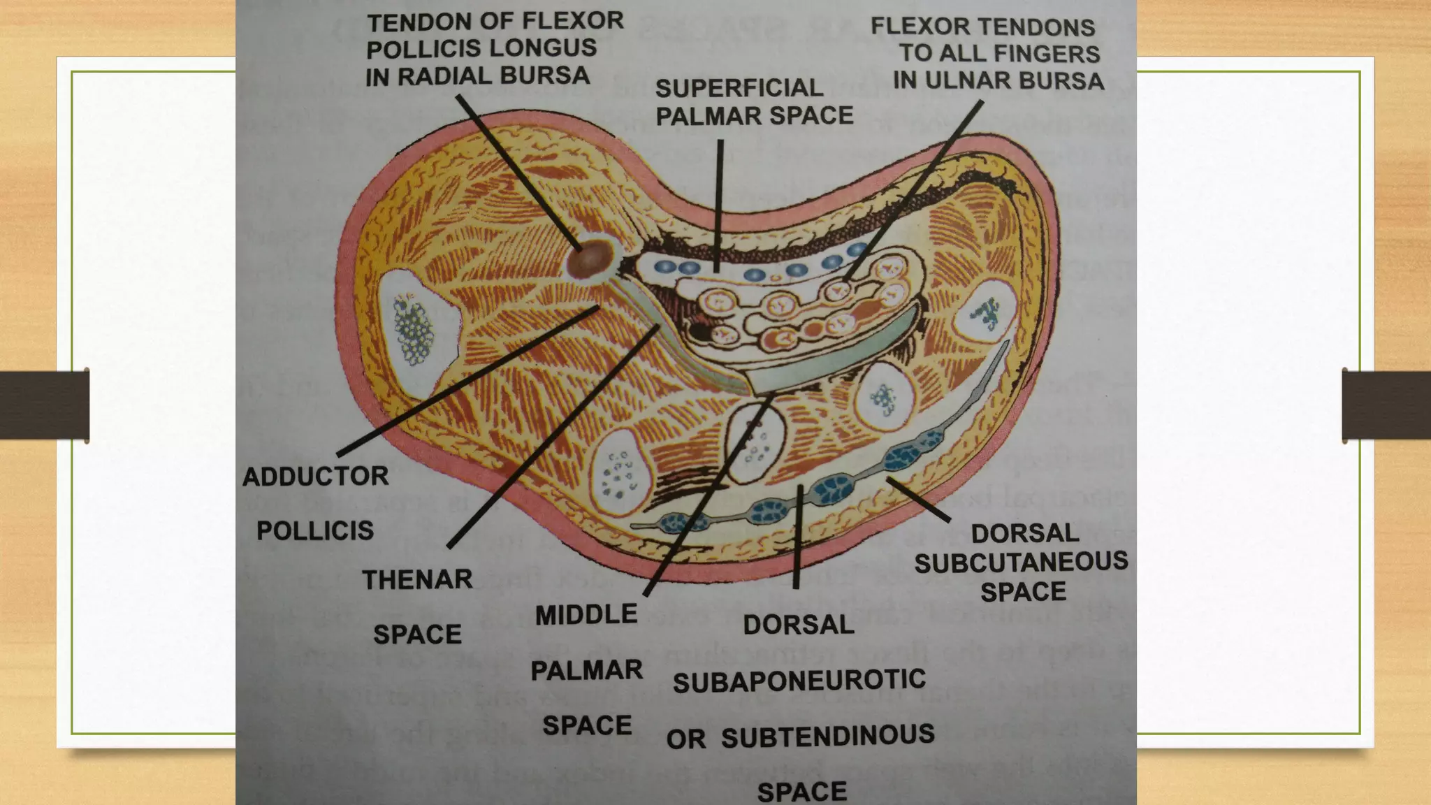Infections of the hand | PPT