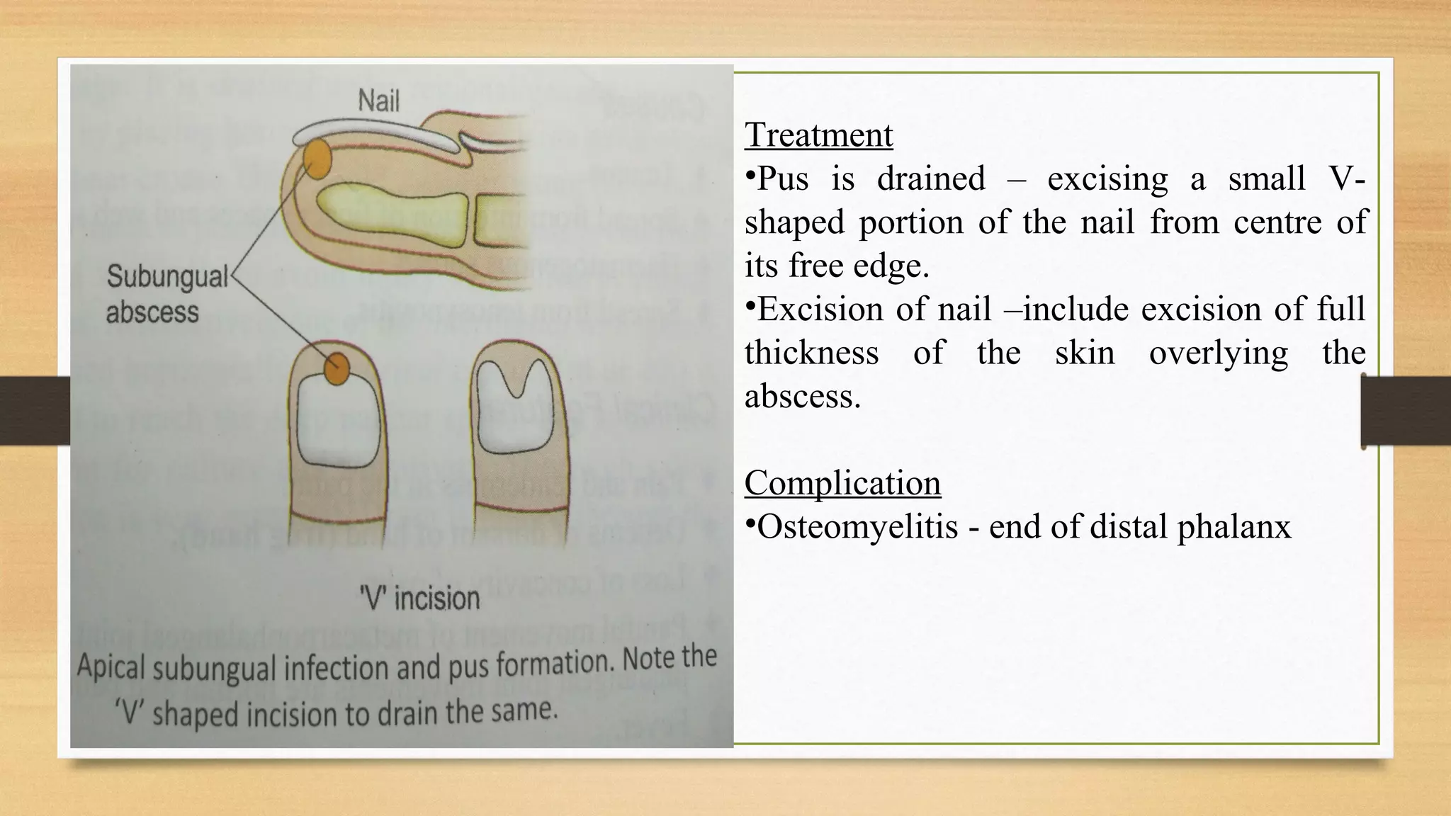 Infections of the hand | PPT