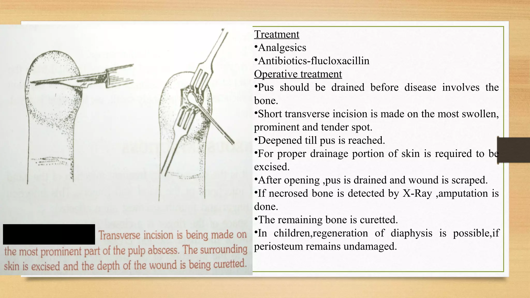 Infections of the hand | PPT