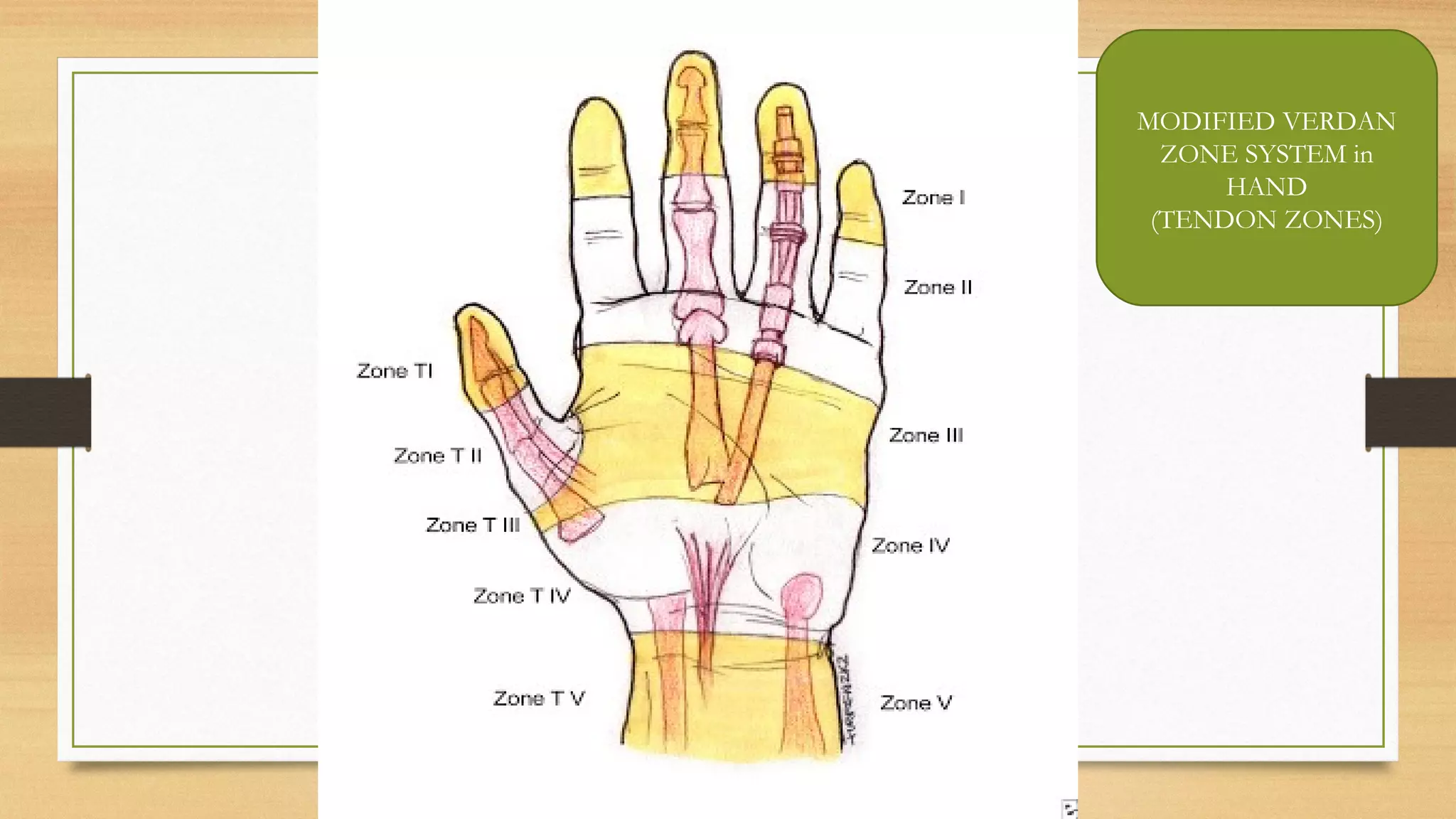 Infections of the hand | PPT