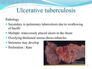 Infections & Tumors of Small Intestine | PDF