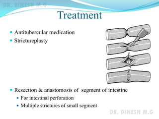 Infections & Tumors of Small Intestine | PDF