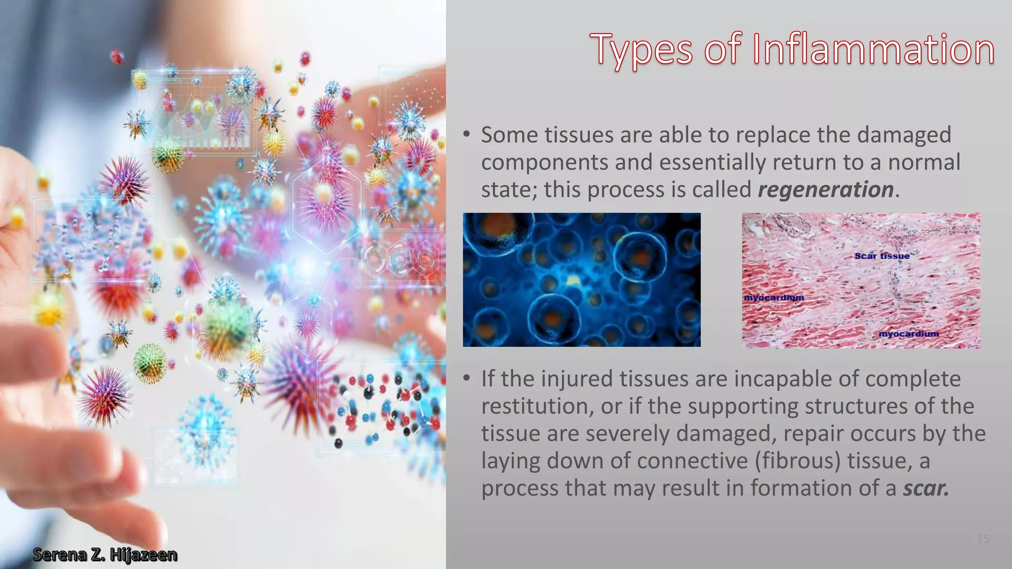 Infections vs inflammation | PPTX