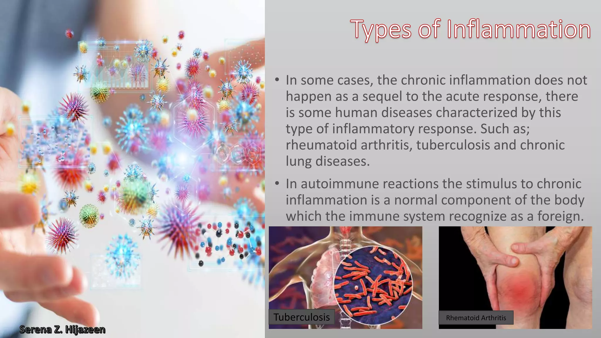 Infections vs inflammation | PPTX