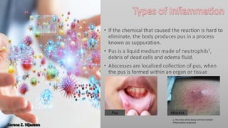 Infections vs inflammation | PPTX