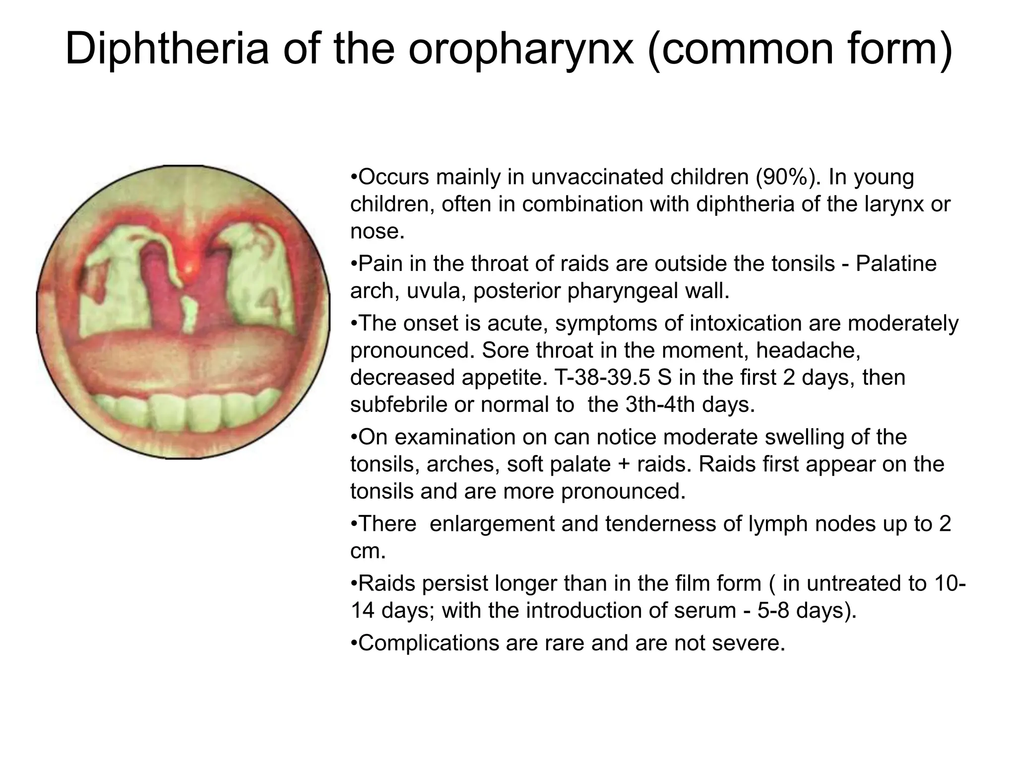infections with the droplet mechanism of transmission.ppt