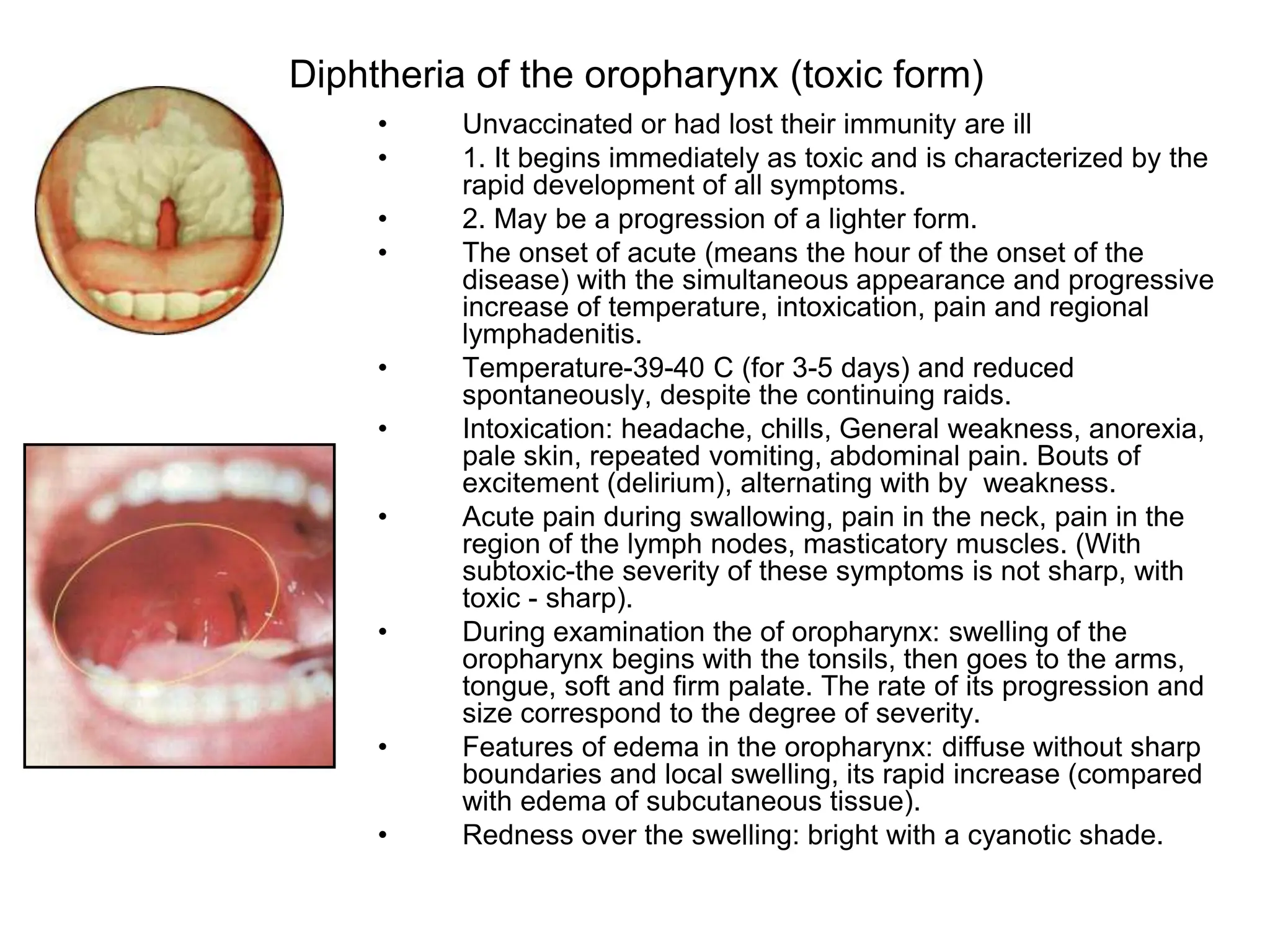 infections with the droplet mechanism of transmission.ppt