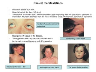 infections with the droplet mechanism of transmission.ppt