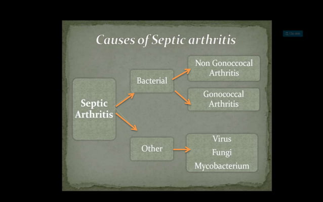 Infectious arthritis | PPTX