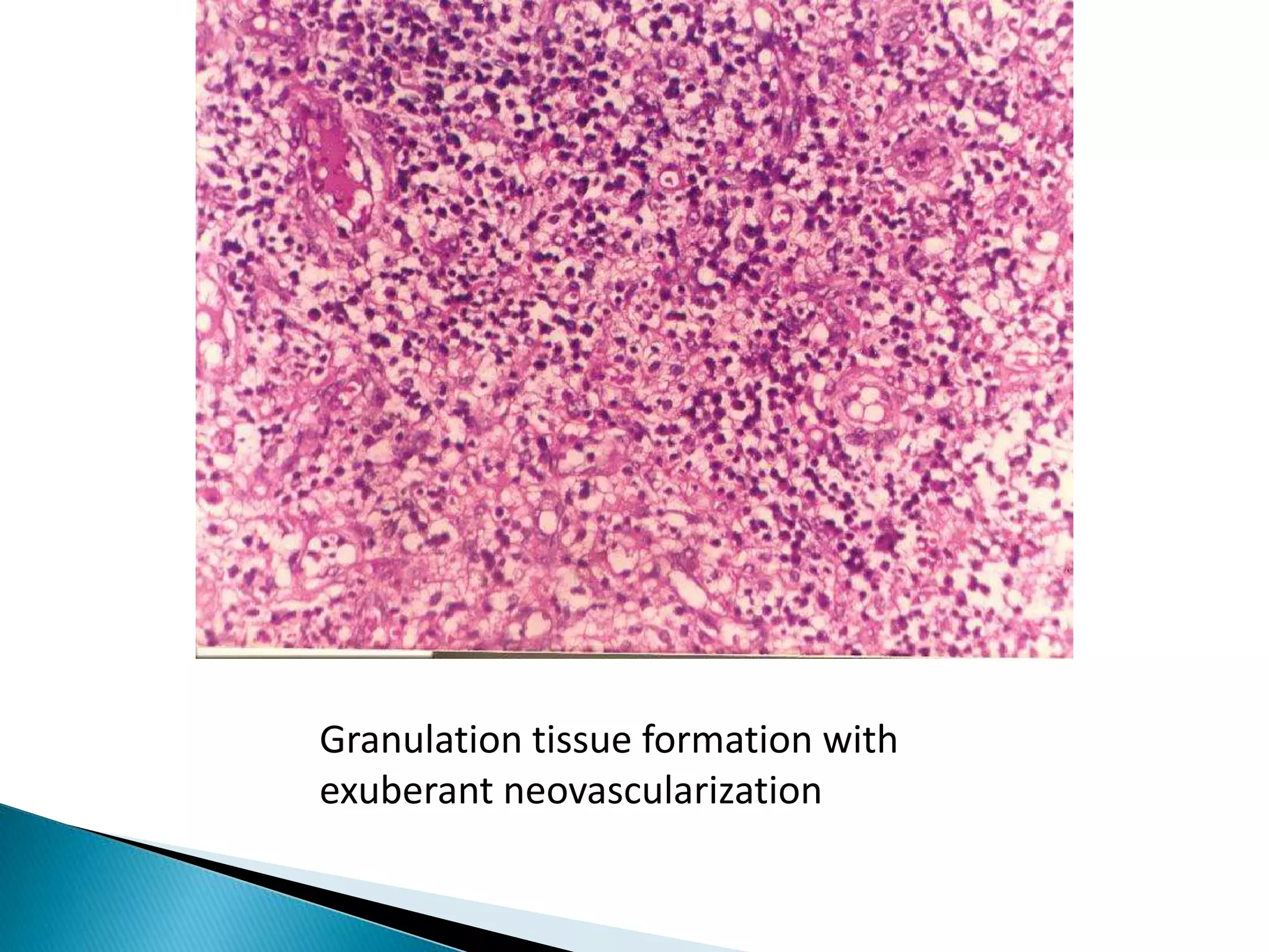 Infectious CNS diseases | PPTX